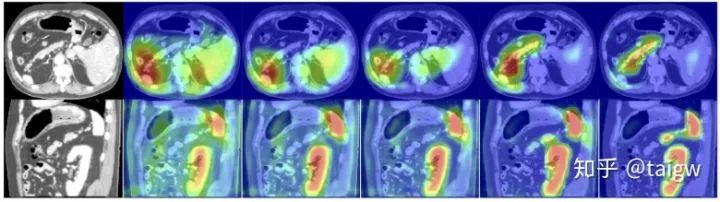 总结 U-Net 网络及他的变体-极市开发者社区