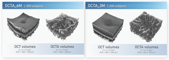 80GB 医学影像数据集！OCTA-500 公开发布-极市开发者社区