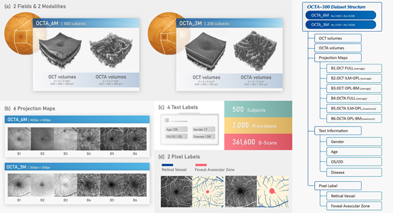 80GB 医学影像数据集！OCTA-500 公开发布-极市开发者社区
